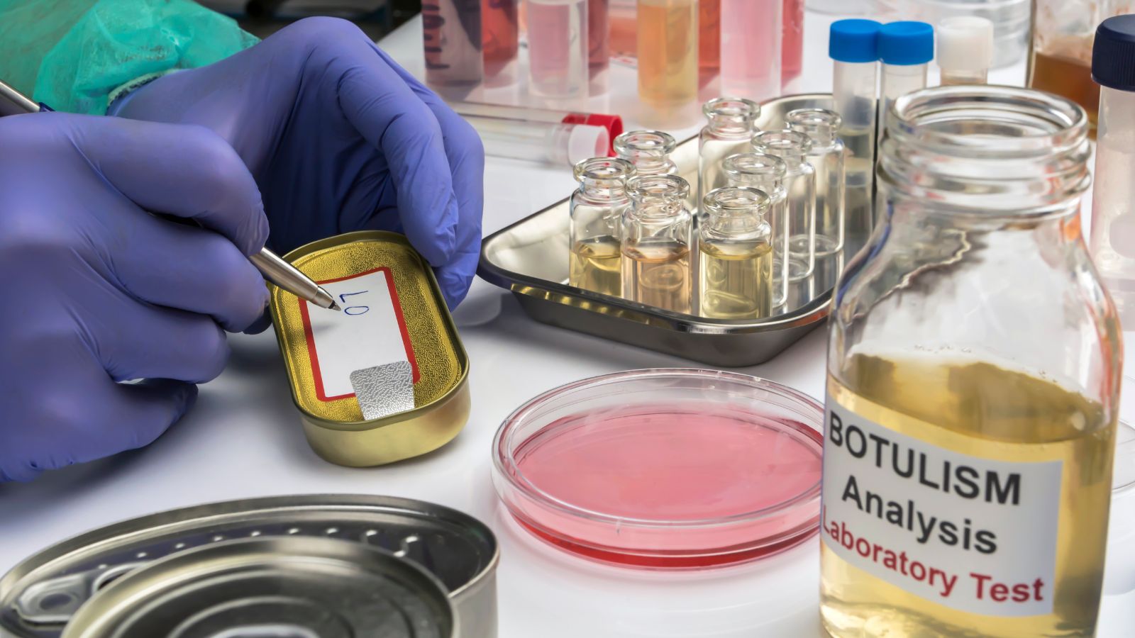 Botulizm: Kendini nasıl gösterir ve neden ortaya çıkar? Sosis zehri ...